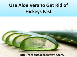 How to Get Rid of Hickeys Fast | PPTX
