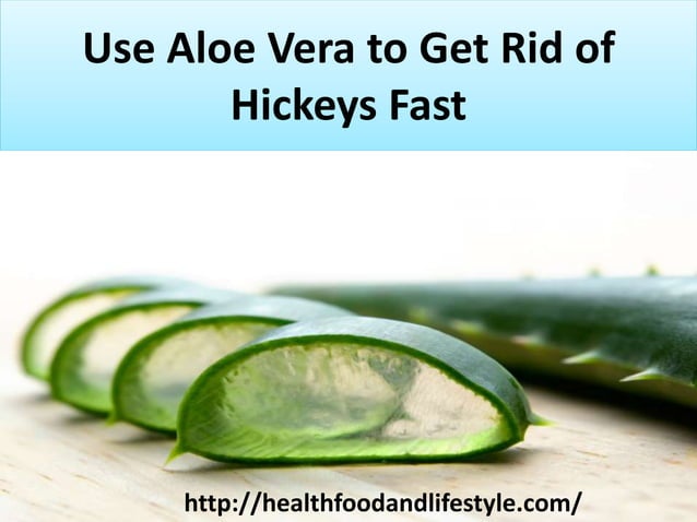 How to Get Rid of Hickeys Fast | PPT