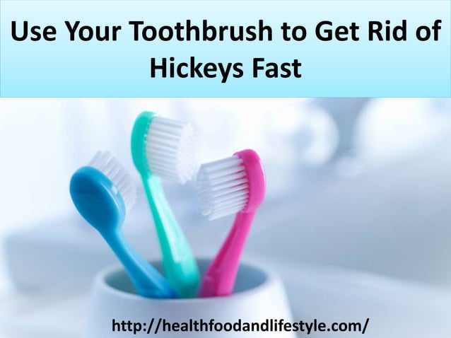 How to Get Rid of Hickeys Fast | PPT