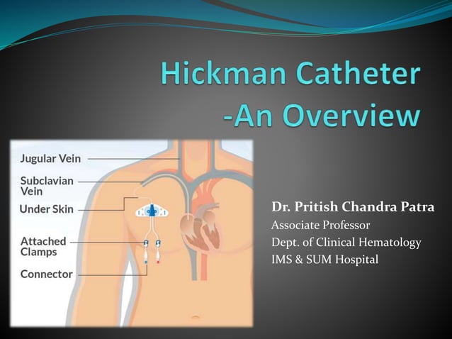 Hickman Catheter- An overview. Details about Hickman, insertion, care ...