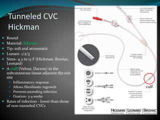 Hickman Catheter- An overview. Details about Hickman, insertion, care ...