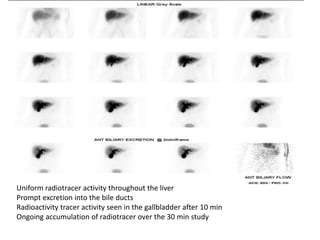 HIDA Scan | PPTX