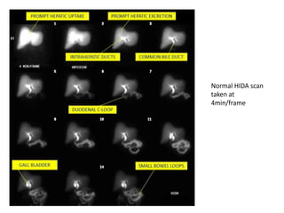 HIDA Scan | PPTX