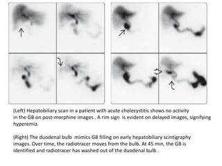 HIDA Scan | PPTX