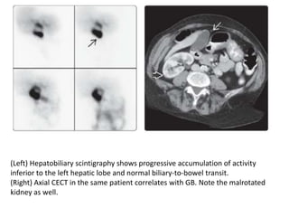 HIDA Scan | PPTX