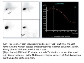 HIDA Scan | PPTX
