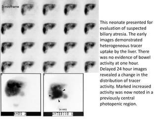 HIDA Scan | PPTX