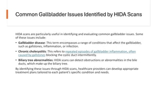 HIDA Scan - A Comprehensive Guide-Texas.pdf