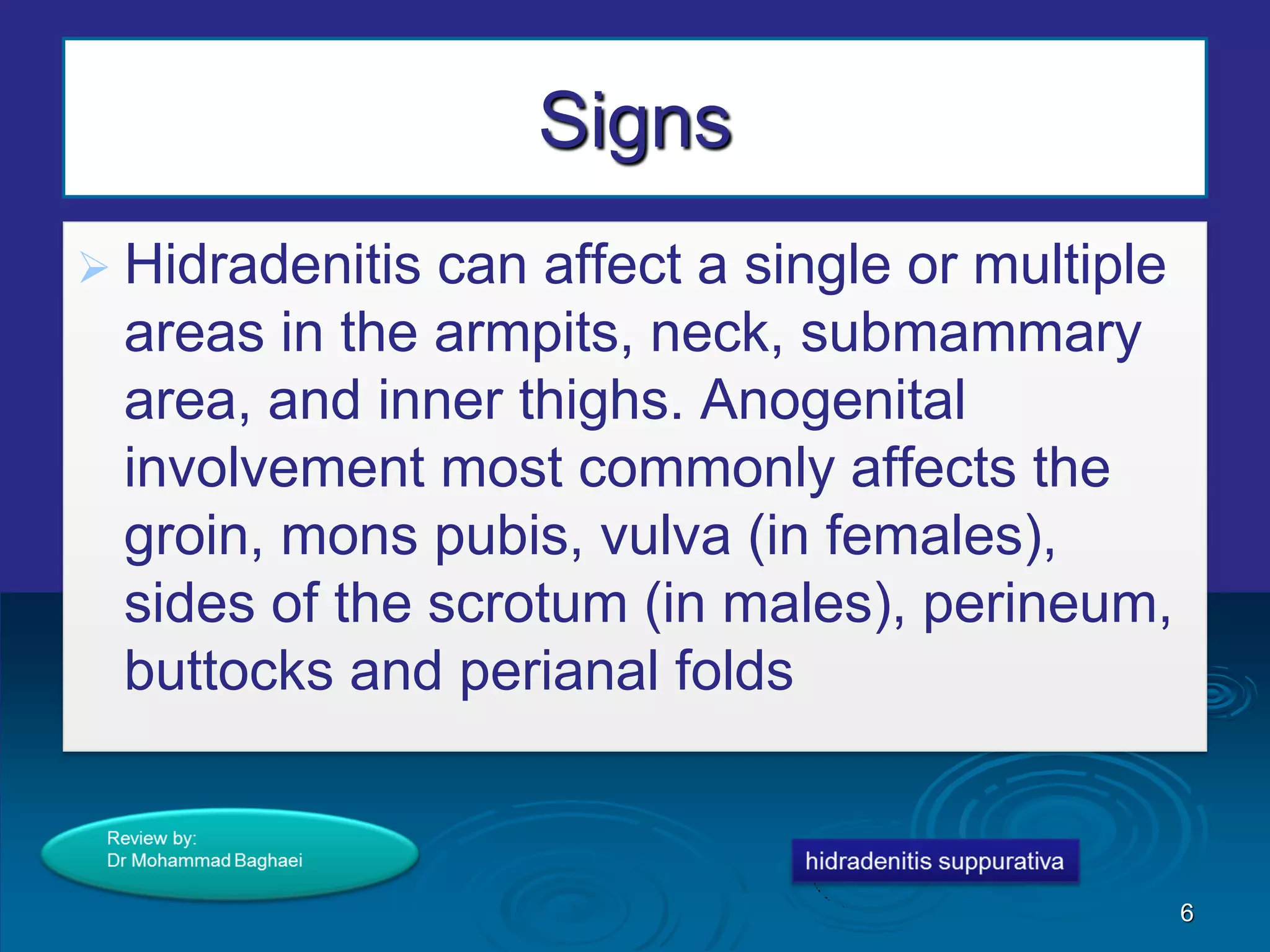 Hidradenitis suppurativa,by Dr Mohammad Baghaei | PDF