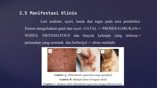 Hidradenitis Suppurativa refarat Isra Nur.pdf