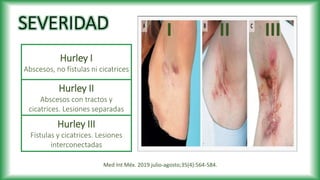 Hidradenitis Supurativa | PPTX
