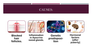 Surgery topic : hydradinitis suppurativa .pptx