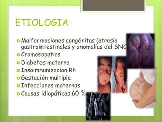 Hidramnios | PPT
