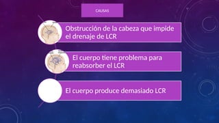 HIDROCEFALIA en el paciente recien nacido | PPTX