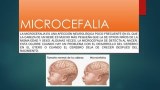 HIDROCEFALIA, MICROCEFALIA, RCP NEONATAL.pptx