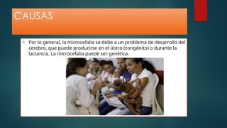 HIDROCEFALIA, MICROCEFALIA, RCP NEONATAL.pptx