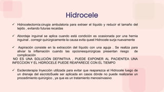 HIDROCELE CONCEPTOS GENERALES Y FISIOPATOLOGIA | PPTX