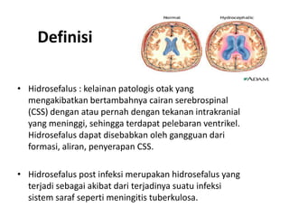 Hidrocephalus post infection | PPTX