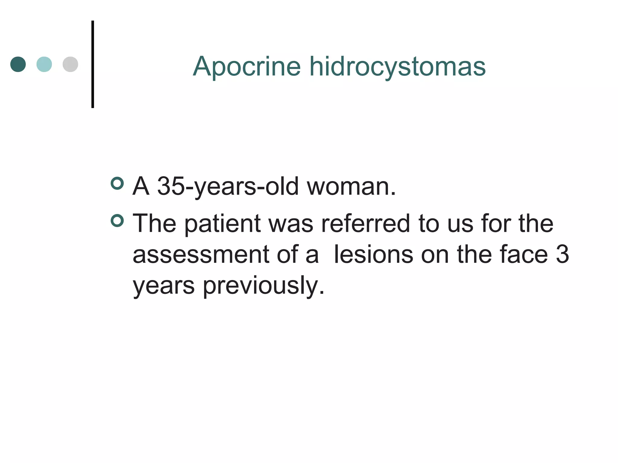 Hidrocystoma apocrine | PPT