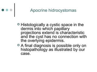 Hidrocystoma apocrine | PPT