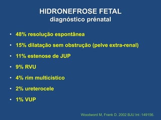 Hidronefrose fetal. | PPTX