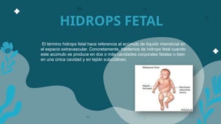 HIDROPS FETAL.pptx sensibilizacion maternofetal rh | PPTX