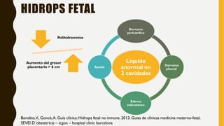 hidrops_fetal ginecología y obstetricia . | PPTX