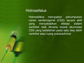 Hidrosefalus | PPTX