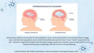 Hidrosefalus pada anak- penumpukan cairan di otak.pptx