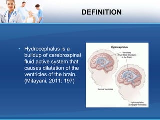 Hidrosefalus on Pediatric | PPTX