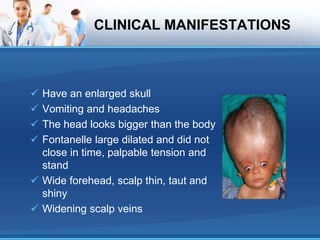 Hidrosefalus on Pediatric | PPTX