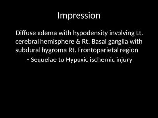HIE.rkg.pptx hypoxic ischemic encephalitis | PPTX