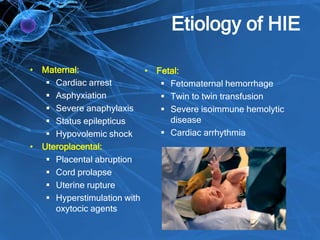 Hypoxic Ischemic Encephalopathy | PPTX