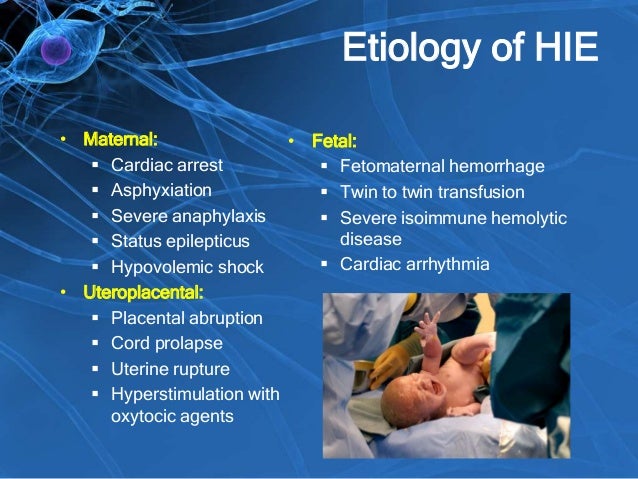 Hypoxic Ischemic Encephalopathy