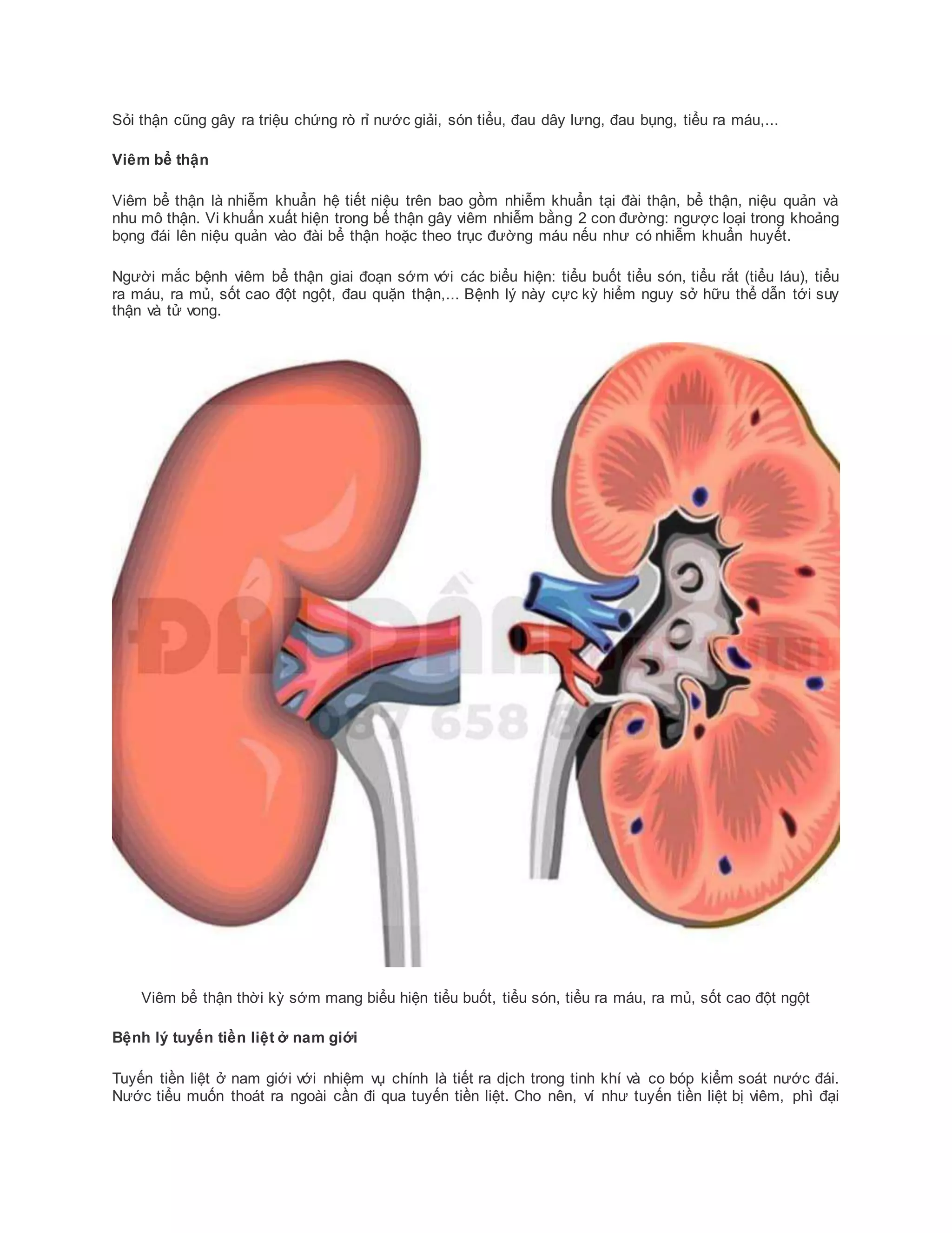 hien tuong di tieu son va buot.docx