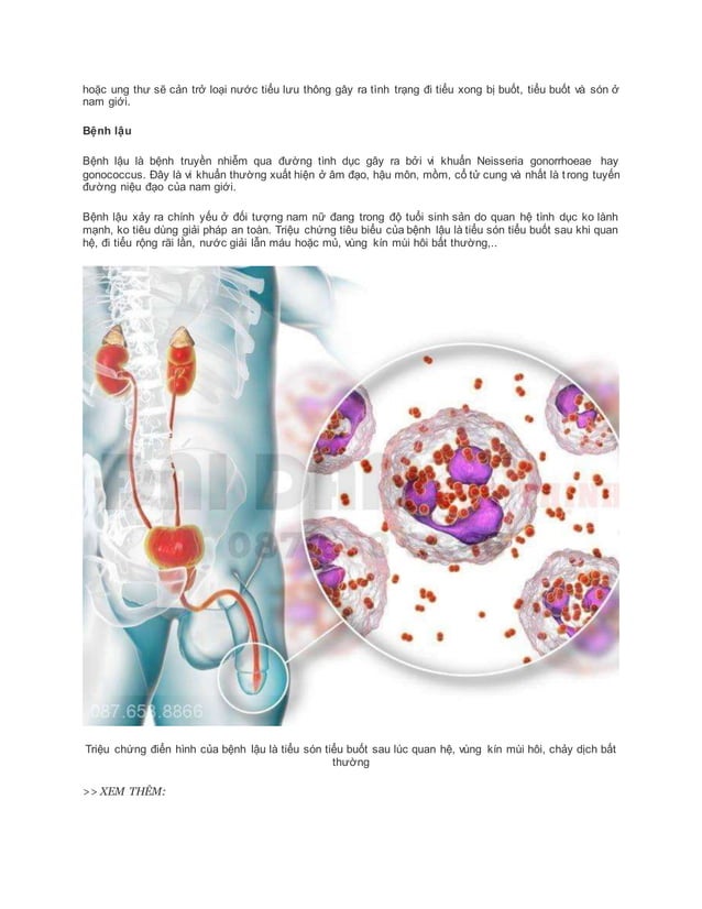 hien tuong di tieu son va buot.docx