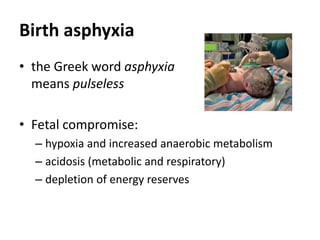 SNS 2017 - Birth asphyxia and HIE management | PPTX