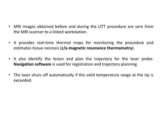 HIFU & LITT.pptx