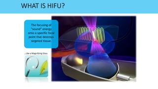 前列腺局灶治療 HIFU | PPT