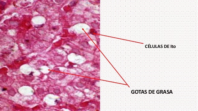 Histología del hígado y vías biliaes