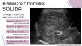 Ecografia Abdominal Higado patologico | PPTX