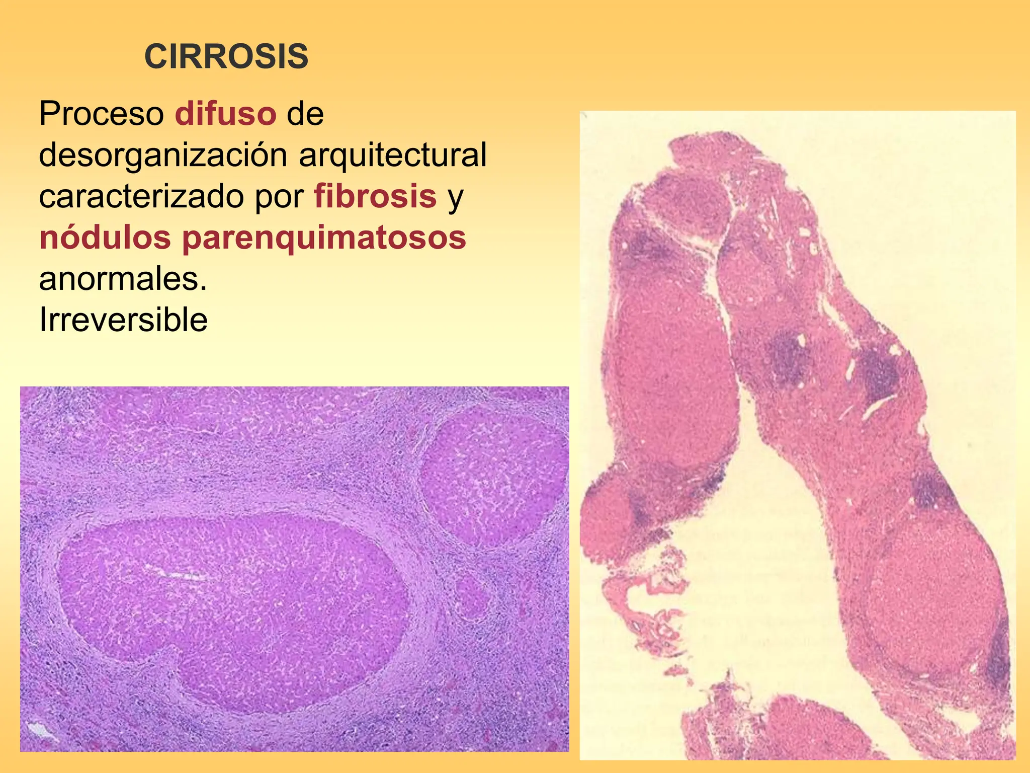 HIGADO PÁNCREAS Y VB ictericia anato.ppt