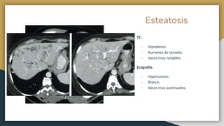 ESTUDIO DE IMAGEN DE HÍGADO, VIAS BILIARES, PÁNCREAS Y RIÑON.pdf