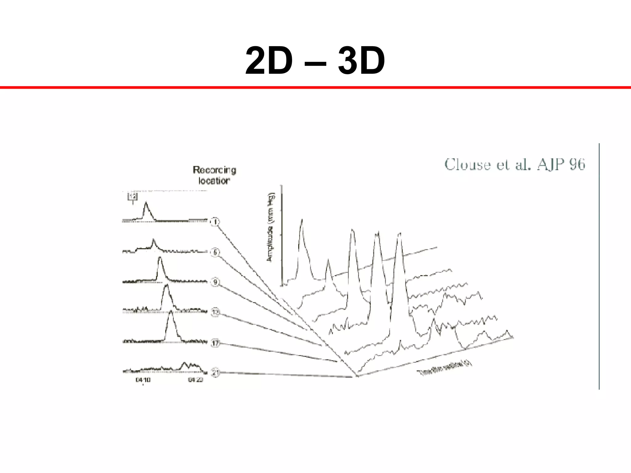 High Resolution Manometry Introduction2 | PPT