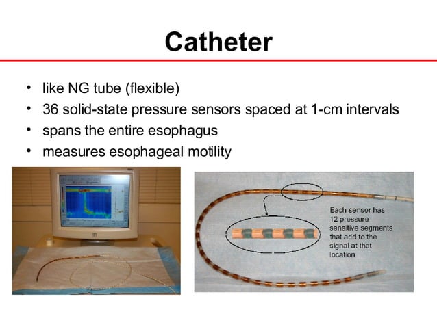 High Resolution Manometry Introduction2 | PPT