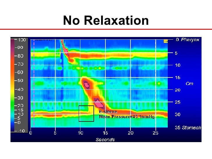 High Resolution Manometry Introduction2