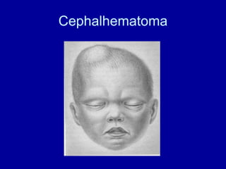 High Risk Neonate | PPT