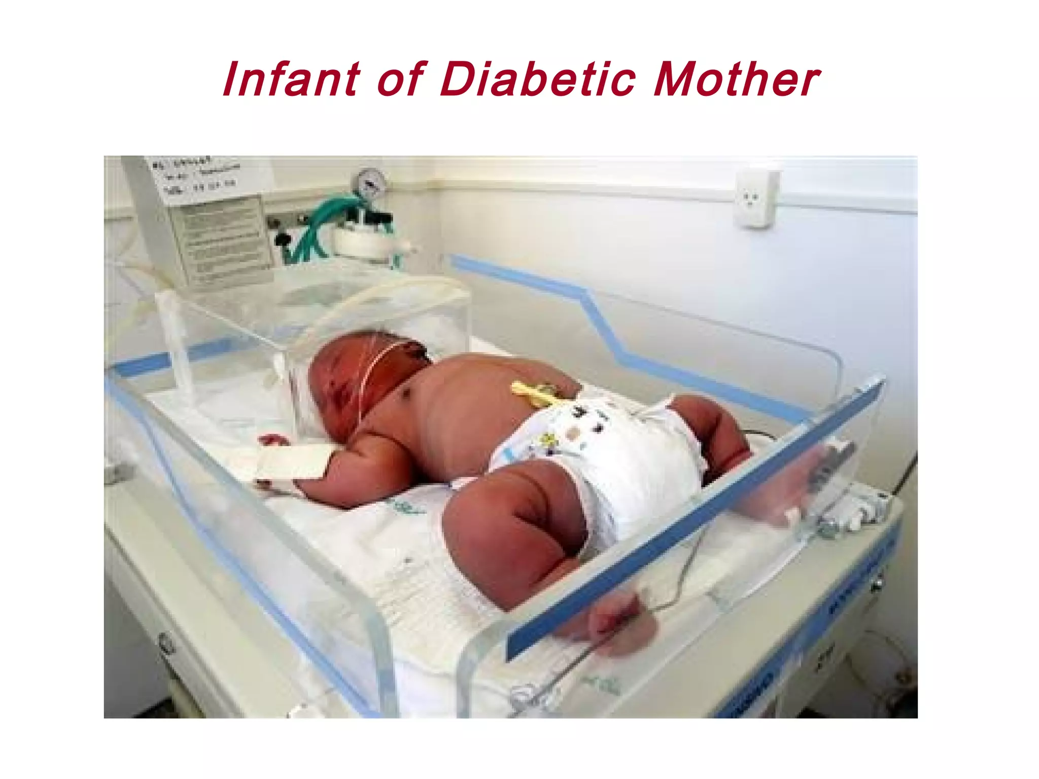 High risk neonate | PPT