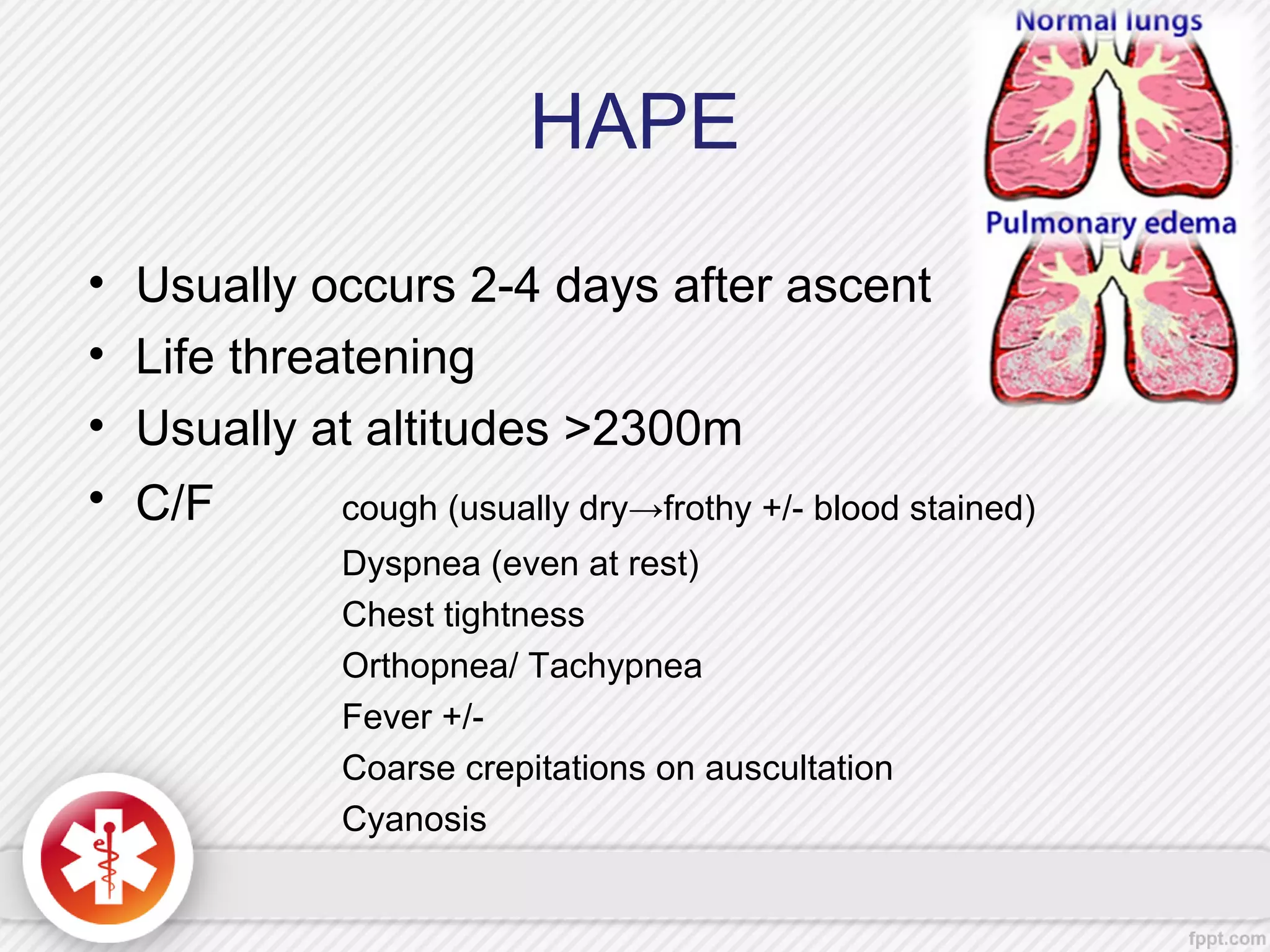 High Altitude Illness | PPT