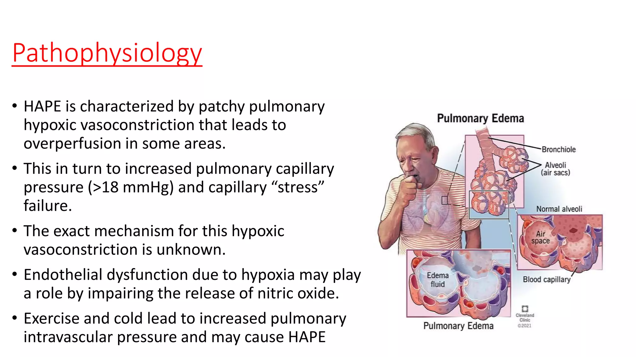 HIGH ALTITUDE PULMONORY EDEMA (HAPE)[2305843009213699724].pptx
